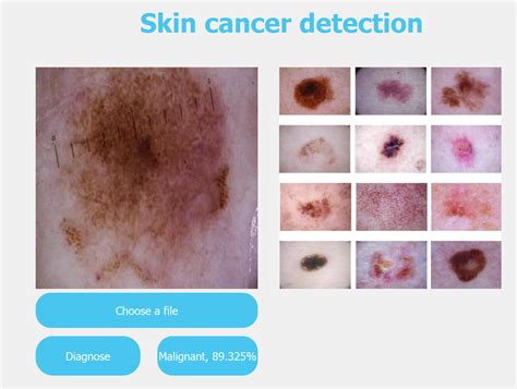 Github Mohdakrory Ai Based Medical Diagnosis System An Ai Based Application That Offers