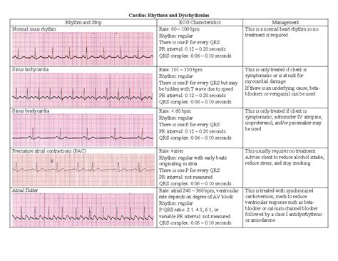 Cardiac Dysrhythmias Cardiac Rhythms And Dysrhythmias Rhythm And