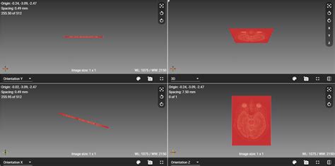 Orientation Of Slices In The 2D Views Issue 463 Kitware Glance