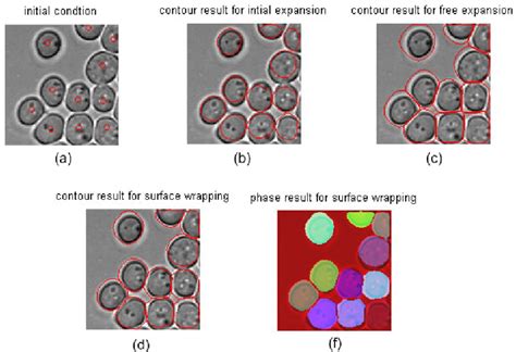 Figure 25 From Cell Segmentation Using Level Set Method Semantic Scholar