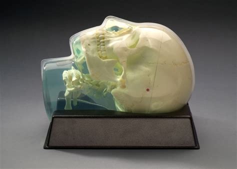 3d Anthropomorphic Skull Phantom Handa Medical Supply Sdn Bhd