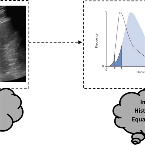 Image Histogram Equalization In Preprocessing Download Scientific Diagram