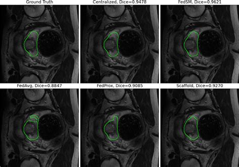 Figure 1 From Closing The Generalization Gap Of Cross Silo Federated Medical Image Segmentation