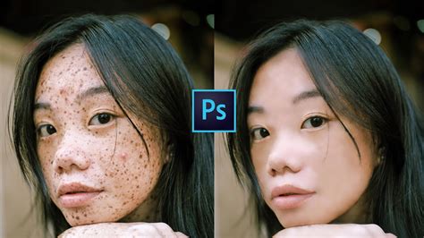 Remove Freckles And Pimples In Photoshop Details Photoshop Tutorial YouTube