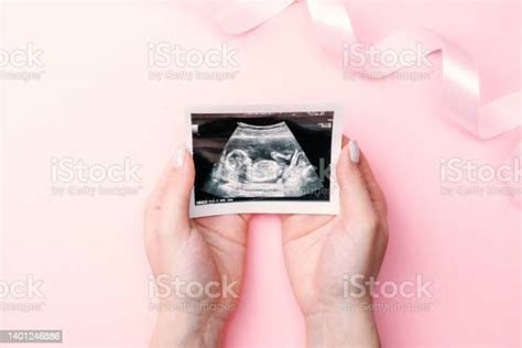 초음파 사진 임신 한 아기 사진 분홍색 배경에 초음파 임신 이미지를 들고있는 여성의 손 임신 출산 아기 출산에 대한 기대의 개념