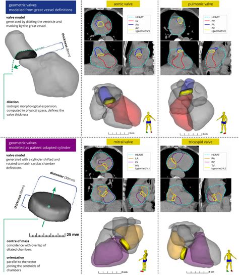 Open Source Fully Automated Hybrid Cardiac Substructure Segmentation