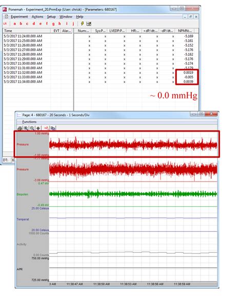 Checking Pressure Offset Prior To Implantation Data Sciences International