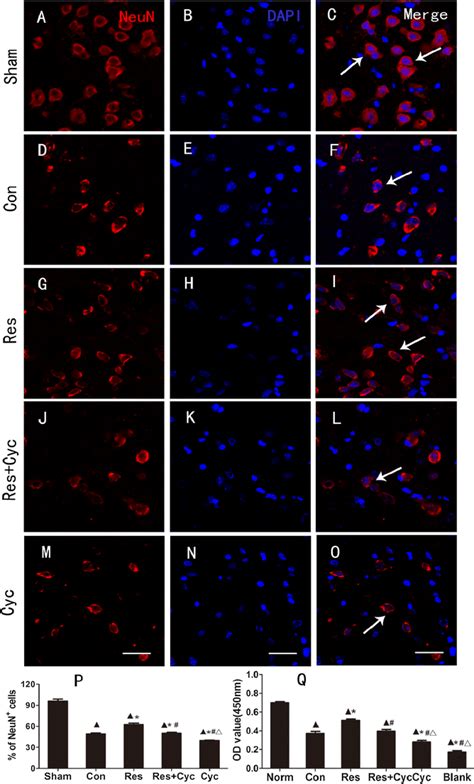 Cyclopamine Inhibits The Effects Of Resveratrol Enhancing The Vitality