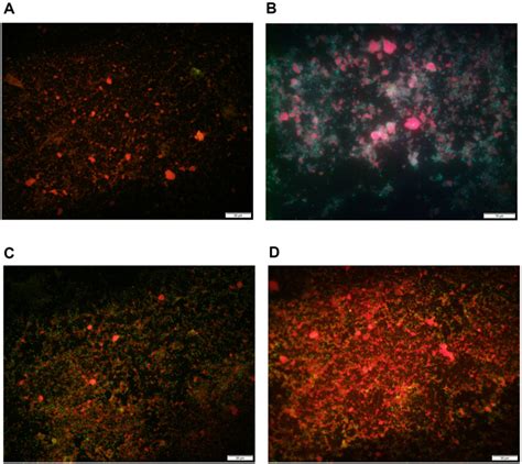 Examples Of Results For The Indirect Immunofluorescent Assay A Download Scientific Diagram