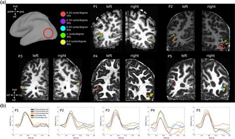 A Spatiotemporal Frequency Preference Within Hmt Roi Of Each Download Scientific Diagram