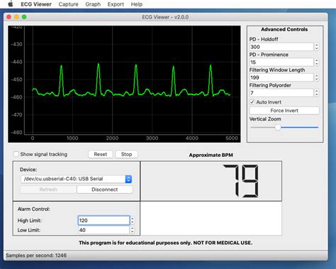 Github Htm Workshop Ecg Viewer Ecg Viewer Is A Graphical Interpreter