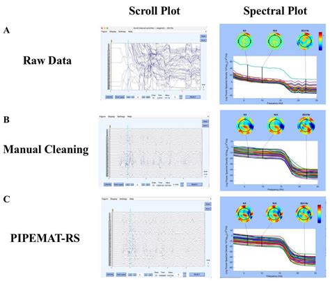 Pipemat Rs Development And Validation Of A Standardized Matlab Pipeline For Resting State Eeg