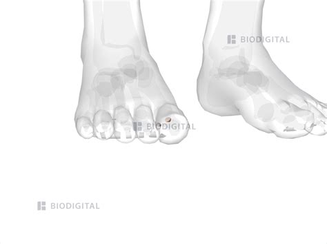 Sesamoid Bones Of Right Foot Biodigital Anatomy
