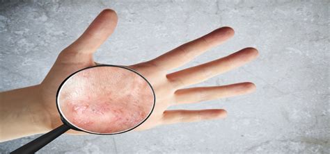 The Nurse Practitioner