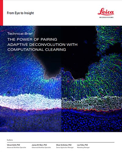 The Power Of Pairing Adaptive Deconvolution With Computational Clearing Microscopy Focus