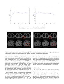QS ADN Quasi Supervised Artifact Disentanglement Network For Low Dose