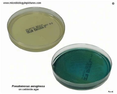 Pseudomonas Agar