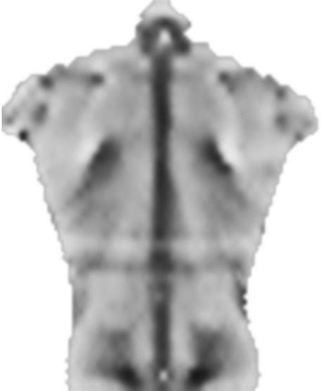 Cross Correlation Finding Symmetric Regionspatterns In Image