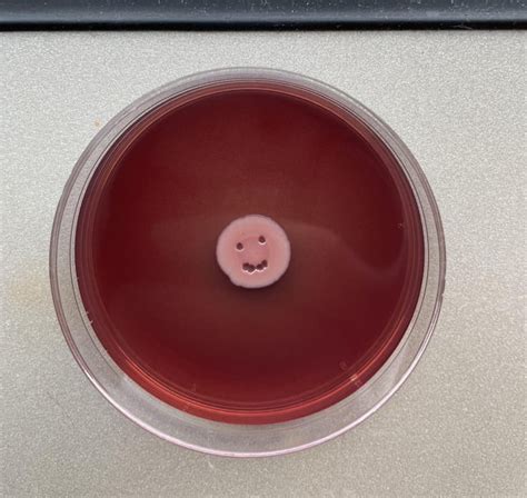 Look At This Happy Lil Biofilm R Labrats