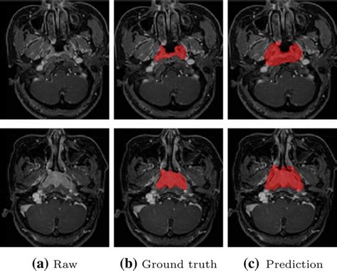 Predicted Results Of Some Samples Using Weighted Cross Entropy The Predicted Results Of Some Samples Using Weighted Cross Entropy The