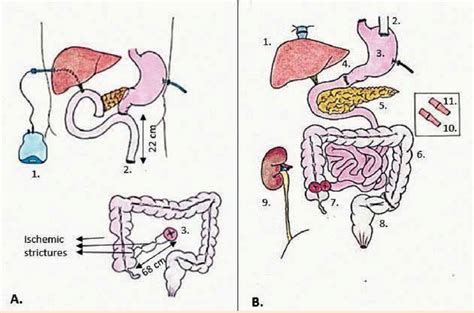 Representation Of The Patients Anatomy Before And After Surgery A Download Scientific