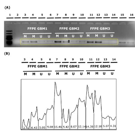 An Example Of Imagej Software Analysis Performed After The Msp Download Scientific Diagram