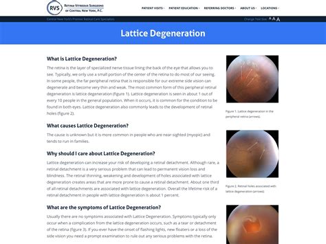Lattice Degeneration Retina Vitreous Surgeons Of Cny