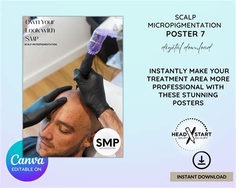 Scalp Micropigmentation Smp Poster Instant Download In Jpeg Or Pdf