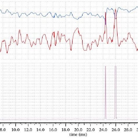 Simulation Results Of Action Potential Detection Download Scientific Diagram