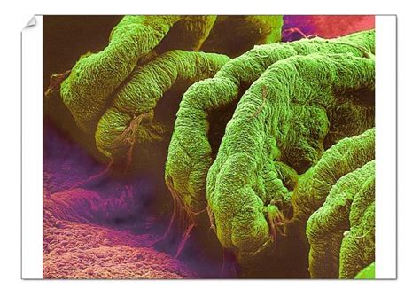 Print Of Ciliary Body Of Eye Sem