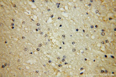 Nkrf Fusion Protein Ag6374 Proteintech