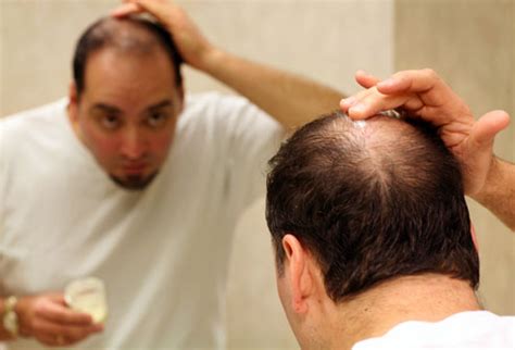How To Stop Balding New Health Guide
