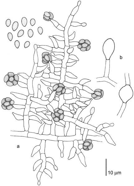 Trichoderma Longibrachiatum Atlas Of Clinical Fungi