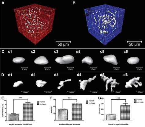 3d Volume Rendering And Quantitative Analyses Of Hepatic Sinusoids In Download Scientific