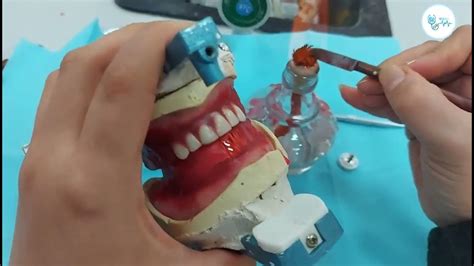 التعويضات السنية المتحركة الكاملة 1 تنضديد الأسنان الأمامية العلوية