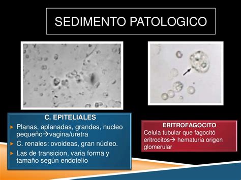 Esame Sedimento Urinario My XXX Hot Girl