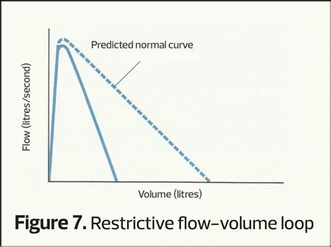 Spirometry Interpretation In The Clinical Situation