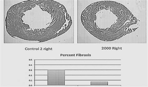 A Wearable Graphene Sensor Used To Monitor Health Pioneering Minds