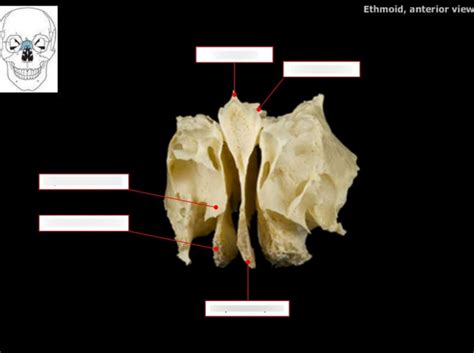 Ethmoid Bone 1 Diagram Quizlet