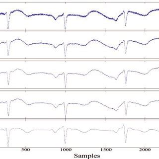 Comparison Of The Baseline Noise Removal By ANN And Traditional Download Scientific Diagram