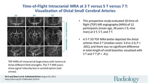 Time Of Flight Intracranial Mra At 3 T Versus 5 T Versus 7 T