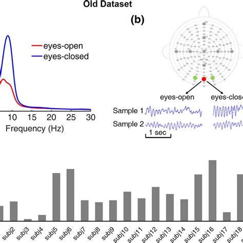Alpha Oscillations During Ec And Eo Resting State In Young Adults A