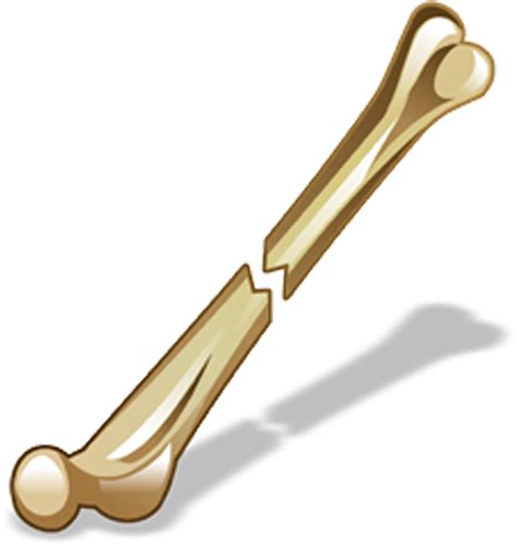 Download Broken Bone Graphic