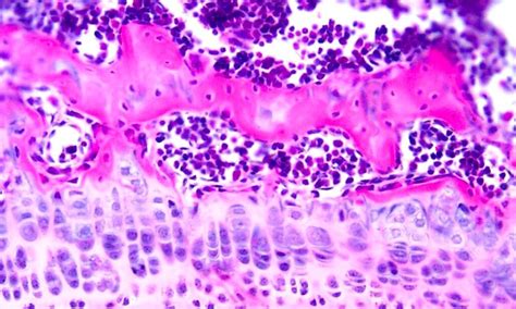 Arrayit Bone Cartilage Human Tissue Microarray 6 Cases And 24 Cores