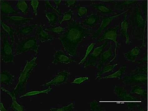 Monoclonal Anti-LETM1 antibody produced in mouse clone 2C6, purified ...