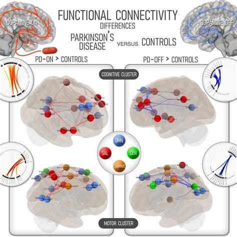 differences in functional connectivity between nondemented parkinson s