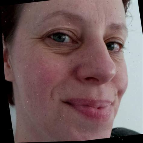 Skin Types3 Classification Dataset V1 2024 01 23 2 31pm By Theaskin