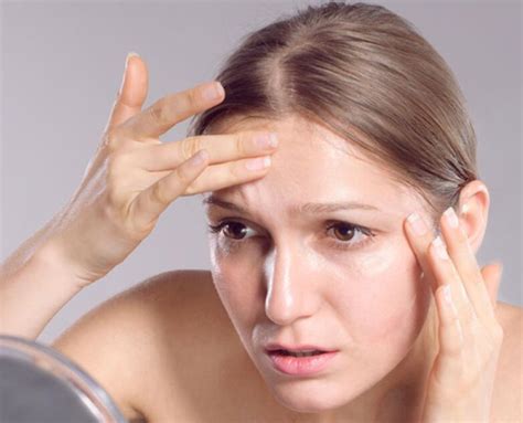 16 Natural Remedies To Tighten Forehead Wrinkles