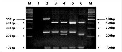 A Multiplex Pcr Rflp For The Simultaneous Detection Of Fvl And Download Scientific Diagram