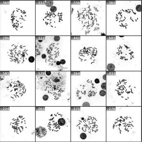 Metaphase Detection Metasystems